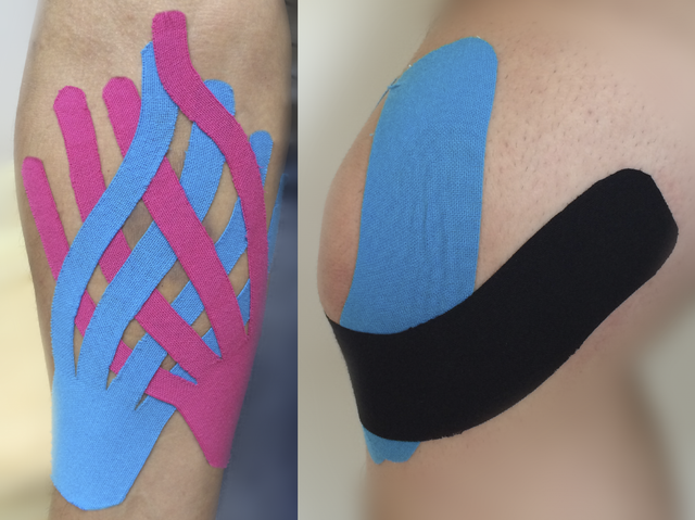 Le Kinesio Taping - Diane Sibille | Ostéopathe - A quoi ça sert